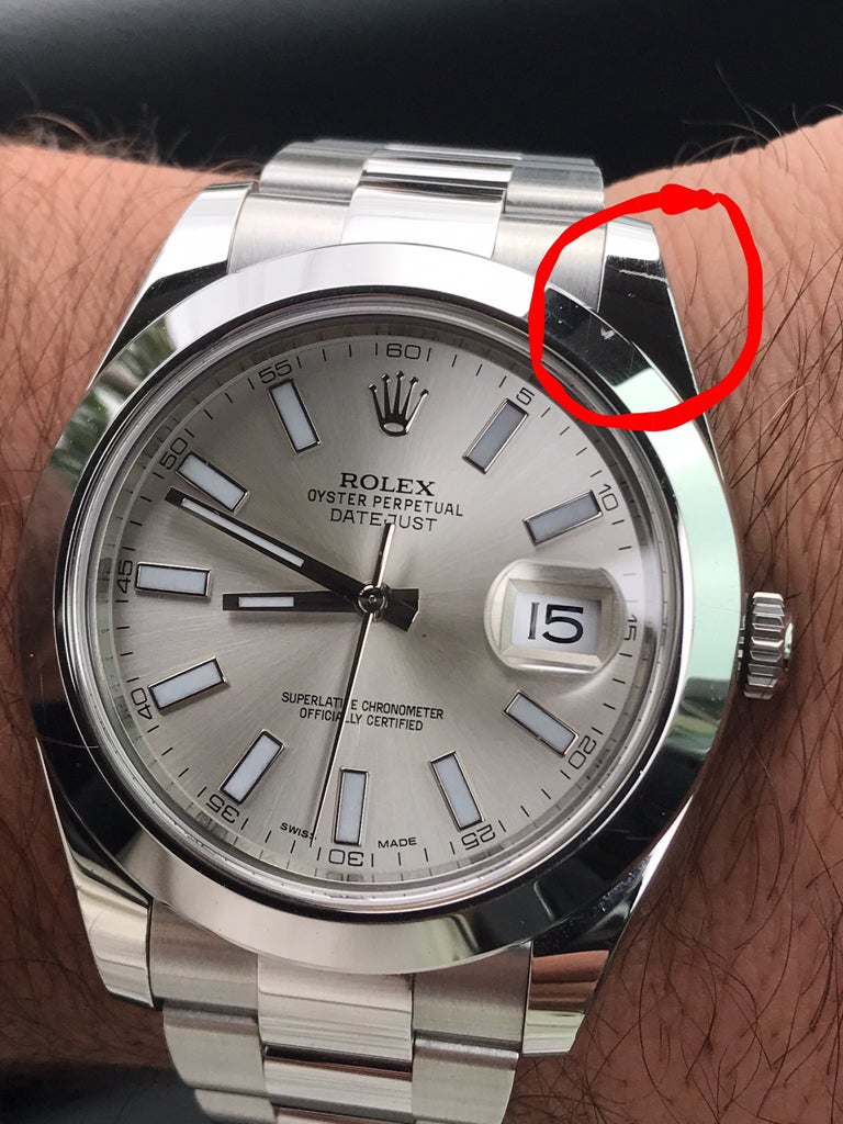 Scratched Rolex Support Group | WatchUSeek Watch Forums