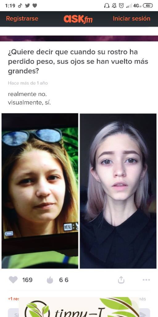 Kate Kusmina BEFORE AND AFTER | Eating Disorder Support Forum