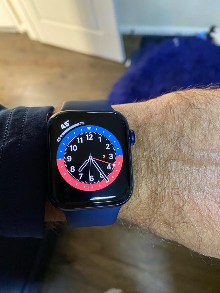 Apple Watch AND Traditional Watch? | WatchUSeek Watch Forums